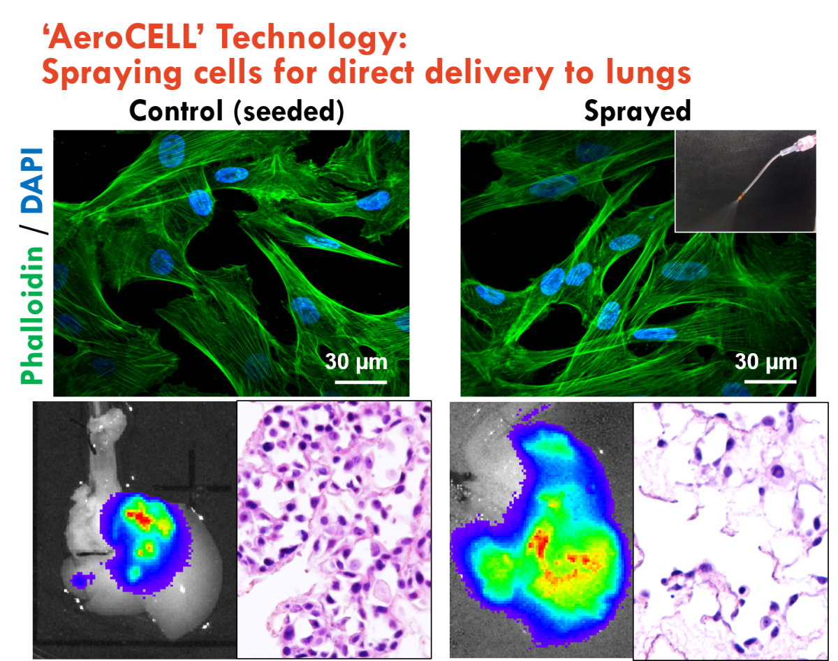 John C Harsanyi Graduate Medal for Innovation 2019 – Congratulations to Sally Kim – Lung ...