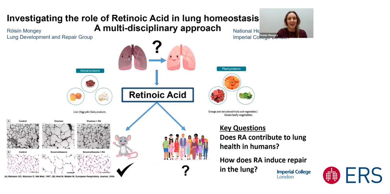 ERS Lung Science Conference Best Poster Award 2021 – Lung Development ...